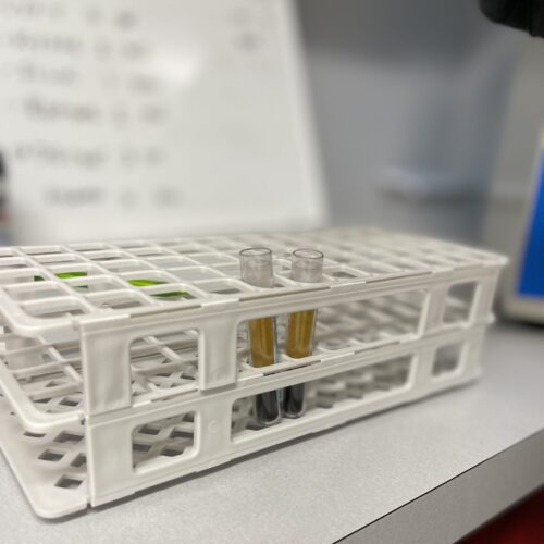 What is a PRP Facial? | My Experience + Before and After - IsabelxMarie