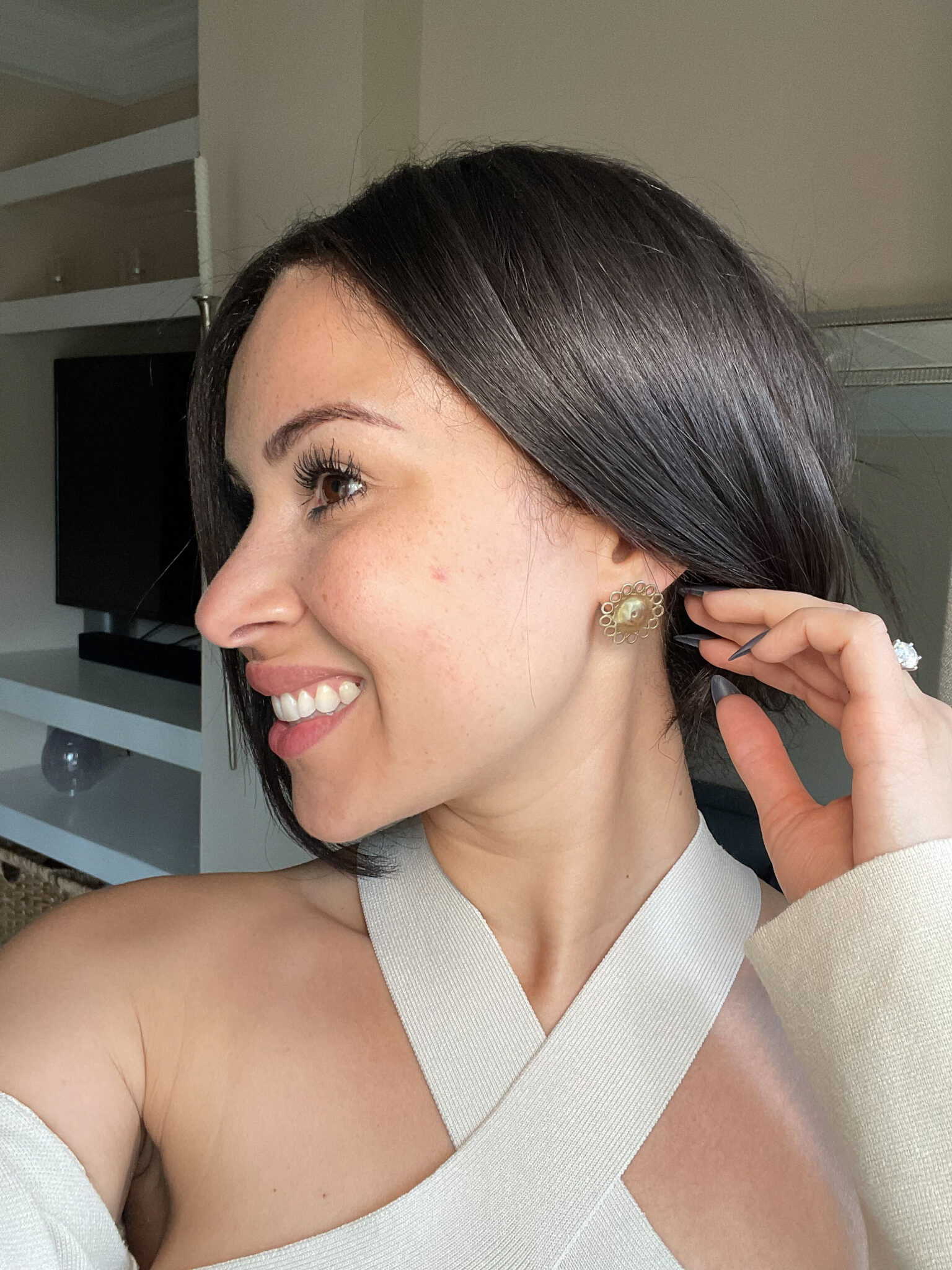 What is a PRP Facial? | My Experience + Before and After - IsabelxMarie