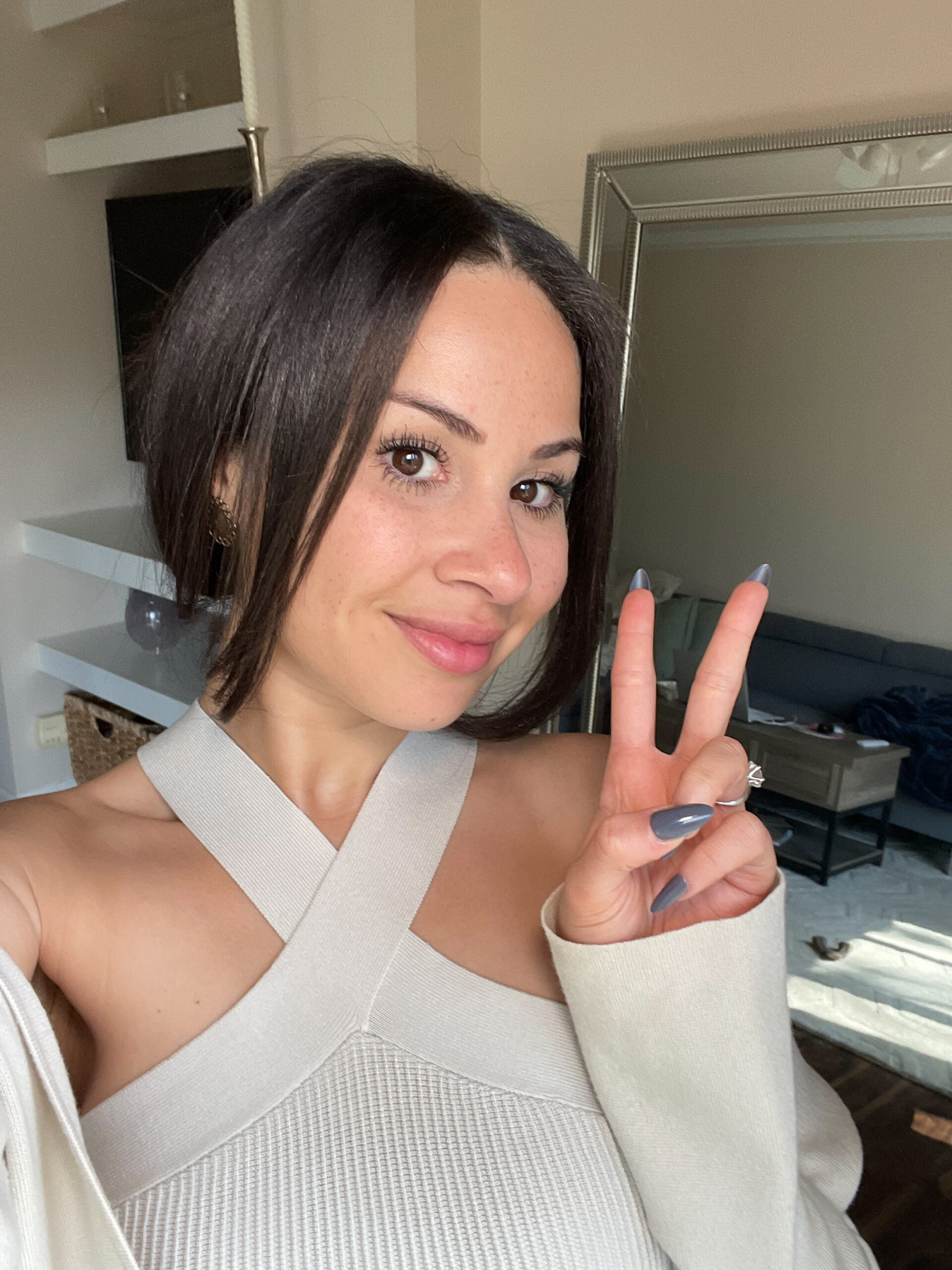 What is a PRP Facial? | My Experience + Before and After - IsabelxMarie