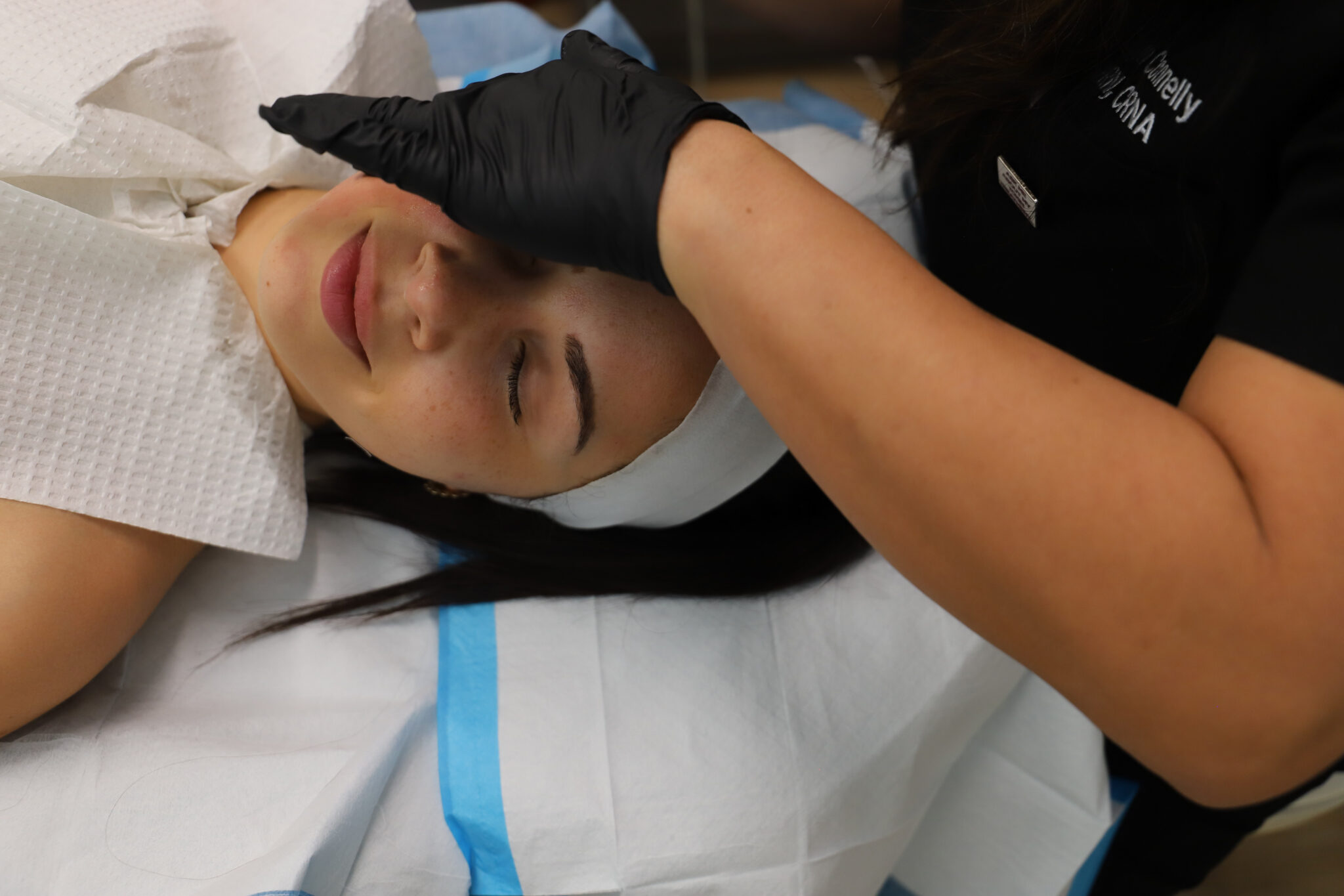 What is a PRP Facial? | My Experience + Before and After - IsabelxMarie